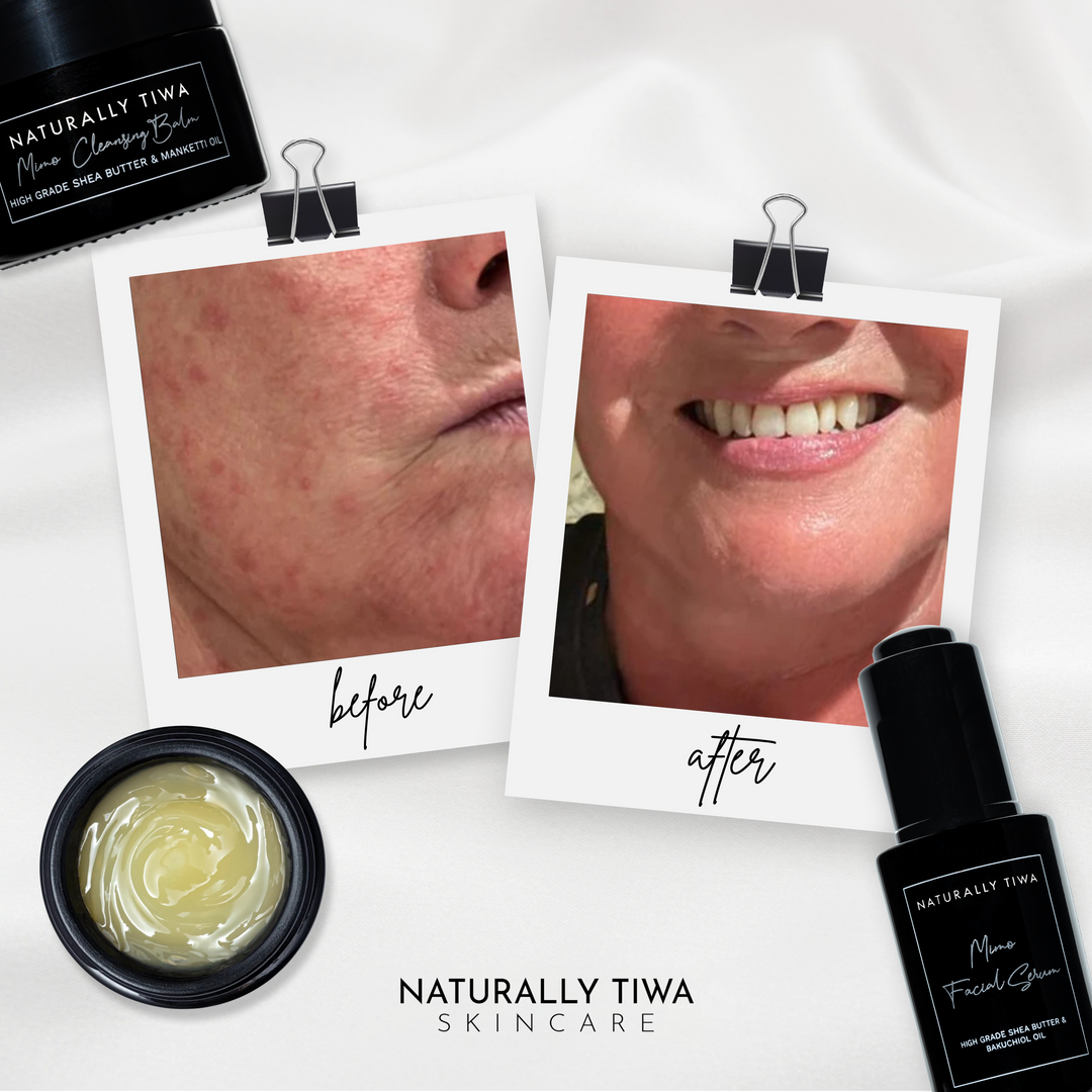 MIMO FACIAL SERUM – Naturally Tiwa Skincare